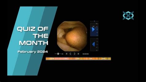 Lipoma Detection Using Capsule Endoscopy Owl Eyes Academy