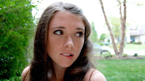 Pin On Freckles And Fair Skin