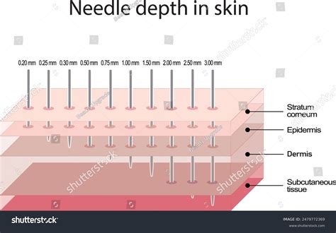 Understanding Depth Needle Penetration Microneedling Cosmetology Stock Vector Royalty Free