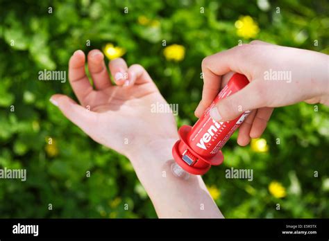 Woman Using An Aspivenin A Poison Sucker Device Against Stings And