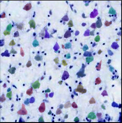 Automatic Cellpose 22 Segmentation Of Neurons In Human Neocortex