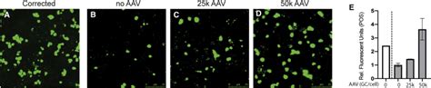 Aav Mediated Gene Augmentation Therapy Restores Critical Functions In Mutant Prpf31 − Ipsc