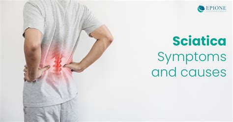 Understanding Sciatica Causes Symptoms Treatment And Pain Relief