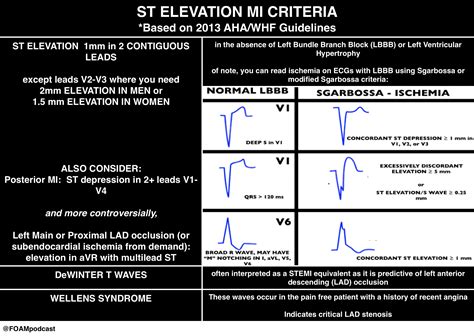 St Elevation Mi