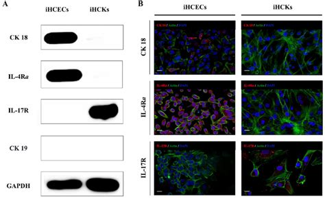 Cornea Related Protein Marker Expression In Immortalized Human Corneal Download Scientific
