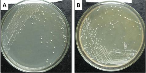 Lactobacillus Casei Colony Morphology A Typical Colony