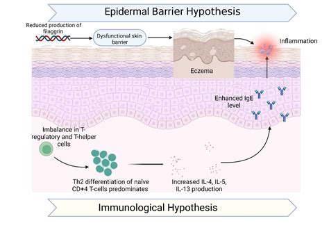 Role Of Actives In Emollients In Atopic Dermatitis