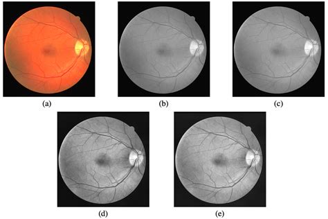 Retinal Vessel Segmentation Based On Fully Convolutional Networks Deepai