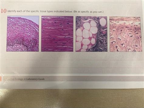 Solved 10 Identify Each Of The Specific Tissue Types