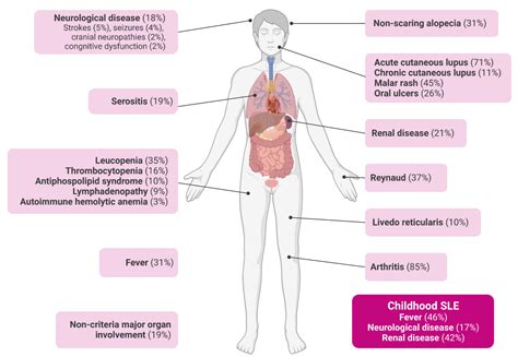 Apa Itu Sle Kenali Penyakit Lupus Yang Boleh Bawa Maut