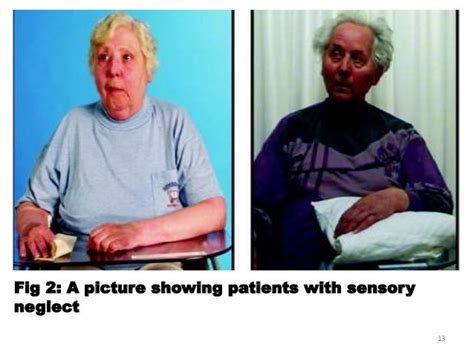 Unilateral Spatial Neglect Ppt