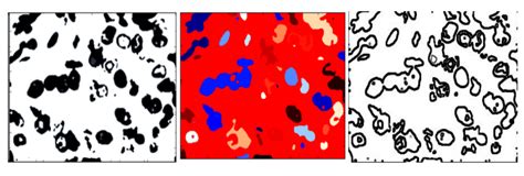 Threshold Segmentation Watershed Segmentation Canny Edge Detection