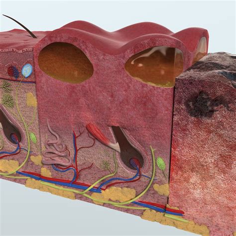 Realistic 3d Skin Burn Anatomy 3d Model 79 Fbx Max Ma Obj