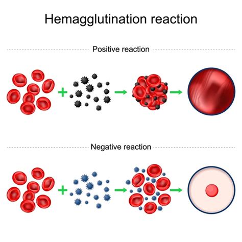 Agglutination Test