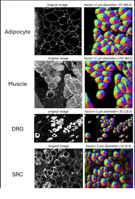 Segment Cells With Cellpose3 10x Genomics