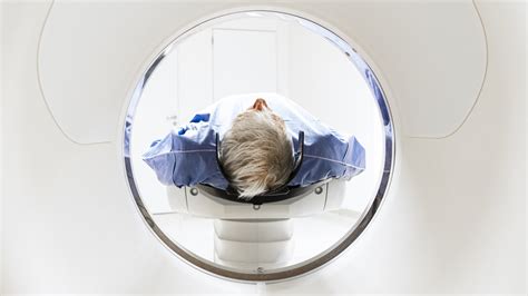 Opinion Body Scans Overestimated In Disease Prevention Benefits Esl News