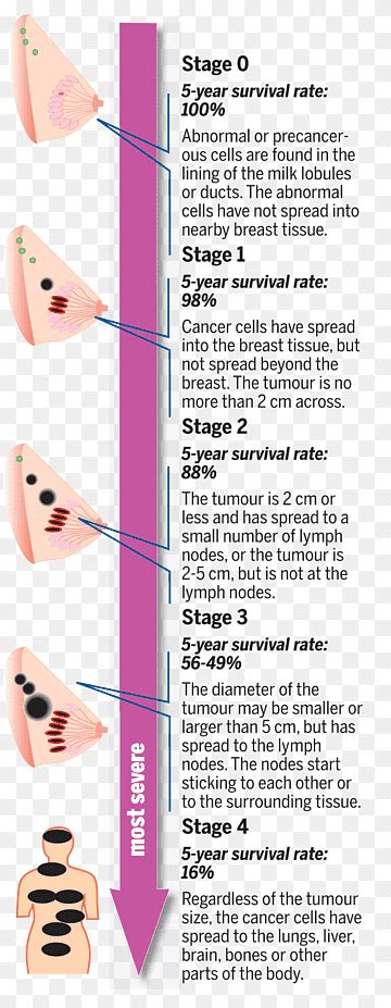 제자리 암종 In Situ In Situ 특별한 유형의 유방암이없는 침윤성 암종 수 유관 기타 선암종 생존율 Png Pngwing
