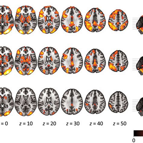 Mean Activation Maps For Positive Correlation With Rpe In The Healthy