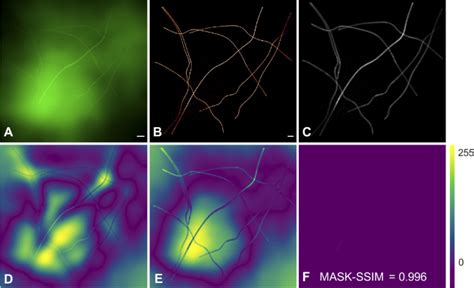 Detector Structural Information Guided Artifact Detection For Super