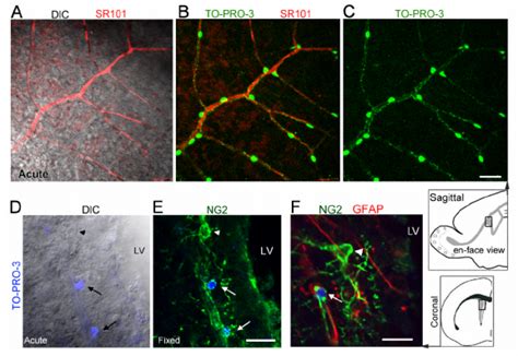 Pericytes Are Labelled With To Pro 3 And Decorate Svz Capillaries Download Scientific Diagram