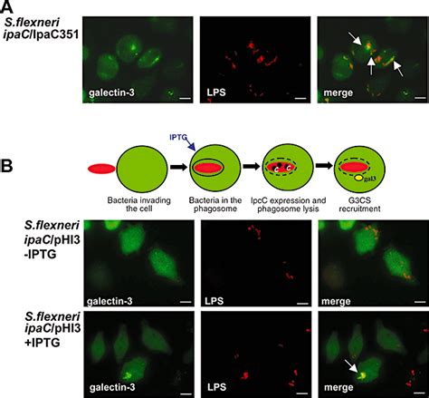 Galectin‐3 A Marker For Vacuole Lysis By Invasive Pathogens Paz
