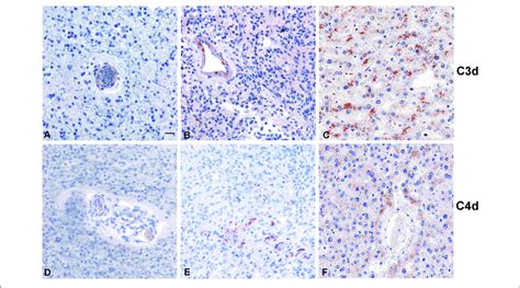 Representative Immunohistochemical Analysis Of C3d And C4d Complement Download Scientific