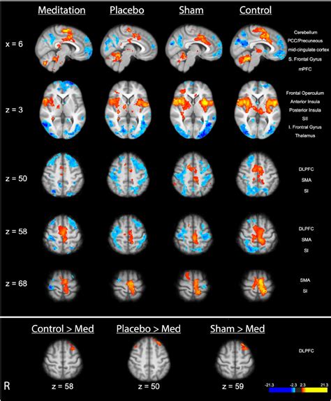 Brain Activations And Deactivations Associated With The Main Effect Of