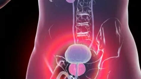 Ai Could Spot Prostate Cancer Faster Slash Nhs Waiting Lists And Prevent Dangerous Side