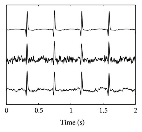 Results Of Source Separation By The Developed Iss Method And Fastica