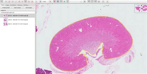 Annotate Slides In Qupath DYI Image Analysis