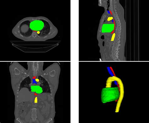 Figure 1 From A 2d Dilated Residual U Net For Multi Organ Segmentation In Thoracic Ct Semantic