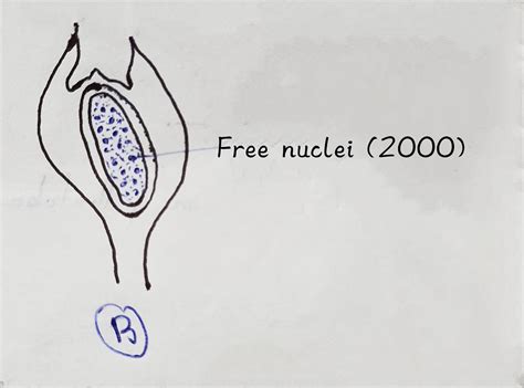 Conifer Morphology Anatomy And Reproduction Types And Characteristics Coniferales ~ Academichunt