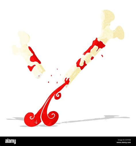 Gross Broken Bone Cartoon Stock Vector Image And Art Alamy