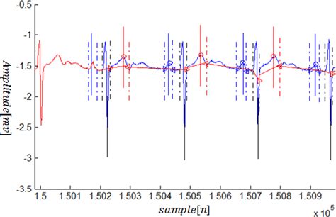 Figure 2 From P Waves And T Wave Detection Algorithm In The Ecg Signals
