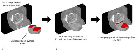 Statistical Shape Model Ssm Segmentation Of The Knee Bone And