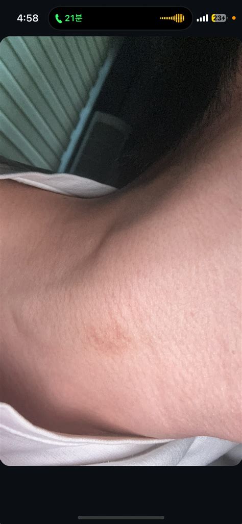 2 키스마크일까요 지식in