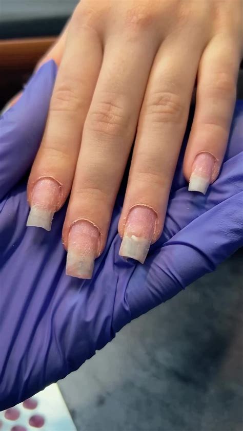 Восстановление боковой стенки ногтя Ремонт ногтя Ногти Маникюр Красивые ногти