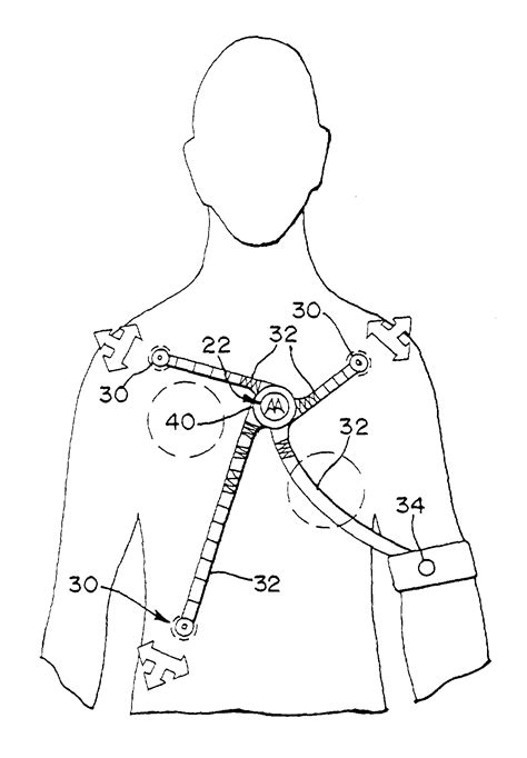 Ecg Monitoring Patented Technology Retrieval Search Results Eureka