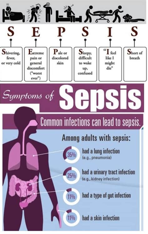 Your Stepbystep Guide To Sepsis Plus A Free Cheat Sheet