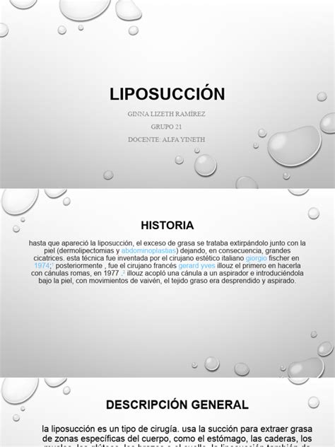 Presentacion Liposucción Pdf