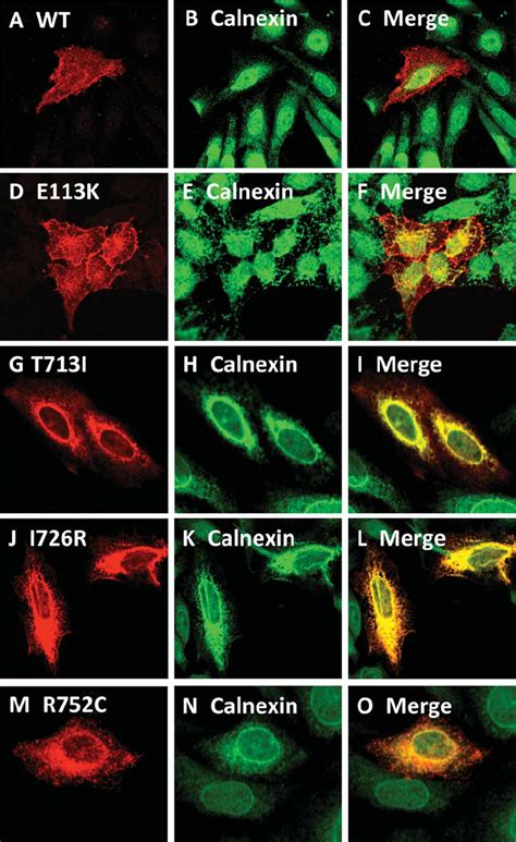 Comparison Of The Intracellular Localization Of Ddr2 Wild Type And