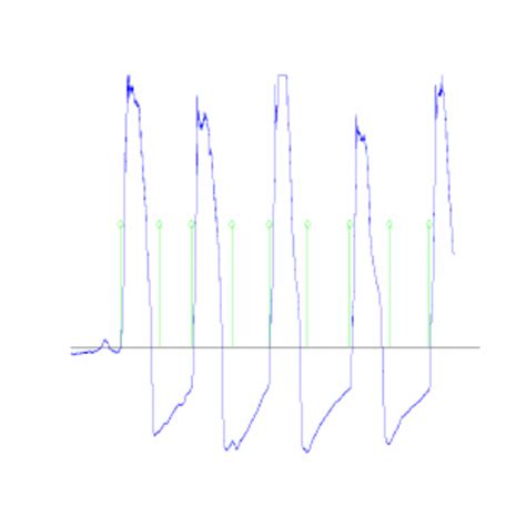 A Denoised Demg Using Daubechies Wavelet Denoised Signal Compared To Download Scientific