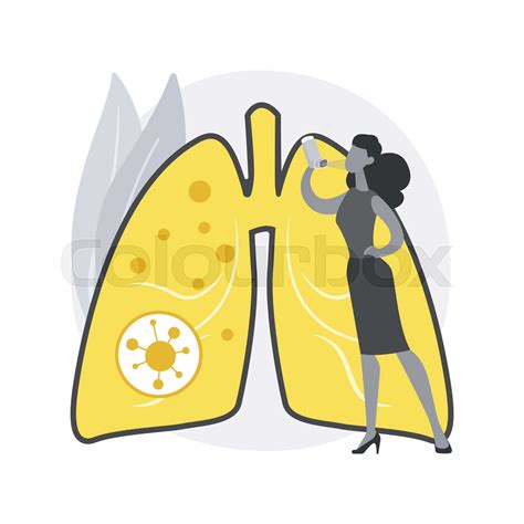 Anaphylaxis Abstract Concept Vector Illustration Severe All Colourbox