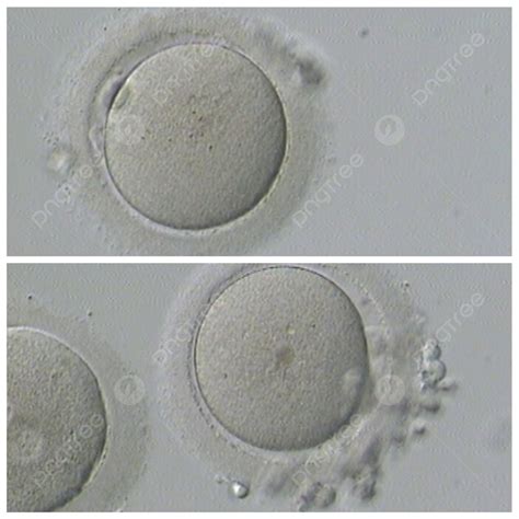 Nền Con Người Ivf Tinh Trùng Thụ Tinh Trong ống Nghiệm Hình Chụp Và Hình ảnh Để Tải Về Miễn Phí