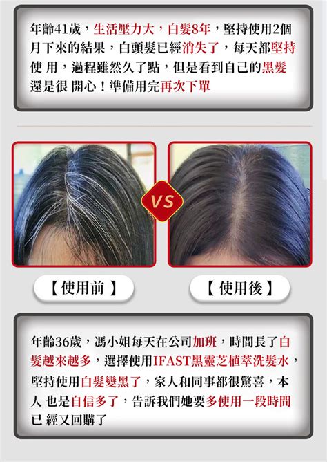 日本ifast黑靈芝防脫育髮乳
