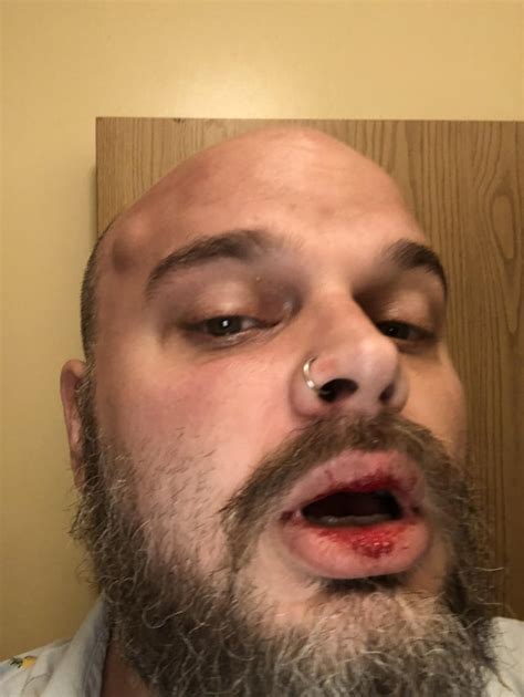 I Was Physically Assaulted By My Step Dad And The Cops Told Me That A Detective Will Reach Out