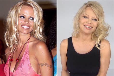 Inside Pamela Andersons Body And Face Transformation See The Former