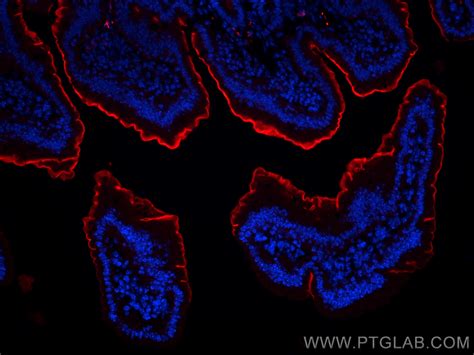 Cd163 Antibody 83285 4 Rr Proteintech