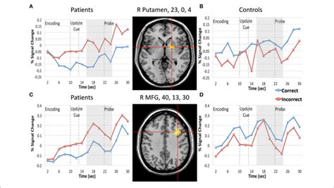 Regions Demonstrating A Diagnosis By Resist Distracter Lure Trial Download Scientific Diagram