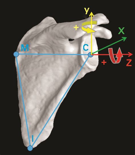 Comparison Of Measurements Of The Glenopolar Angle In 3d Ct